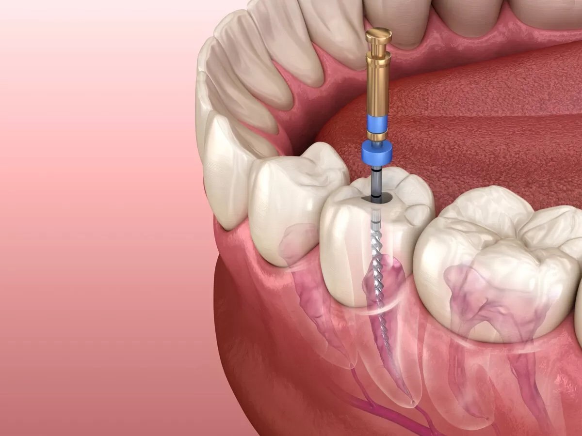 TRATAMIENTOS AVANZADOS - Clinica Dental Durcal